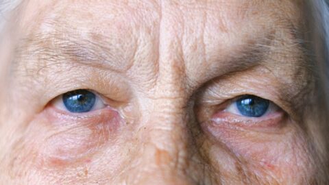 Les 5 causes des cernes et leurs traitements enfin dévoilés